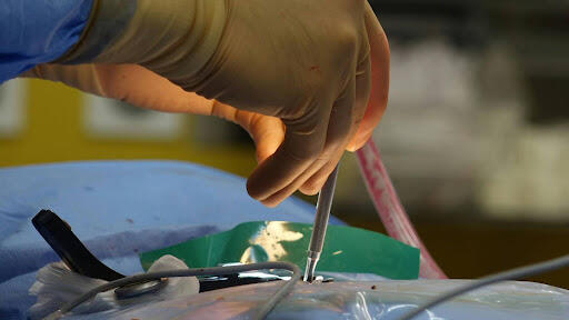 A First-Timer's Guide to Minimally Invasive Spine Surgery in NJ ...