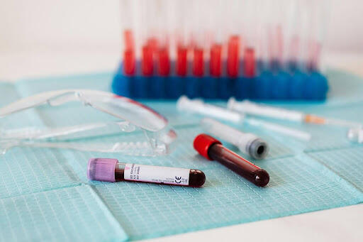 Understanding Toxicology & Blood Tests: A Definitive Guide ...